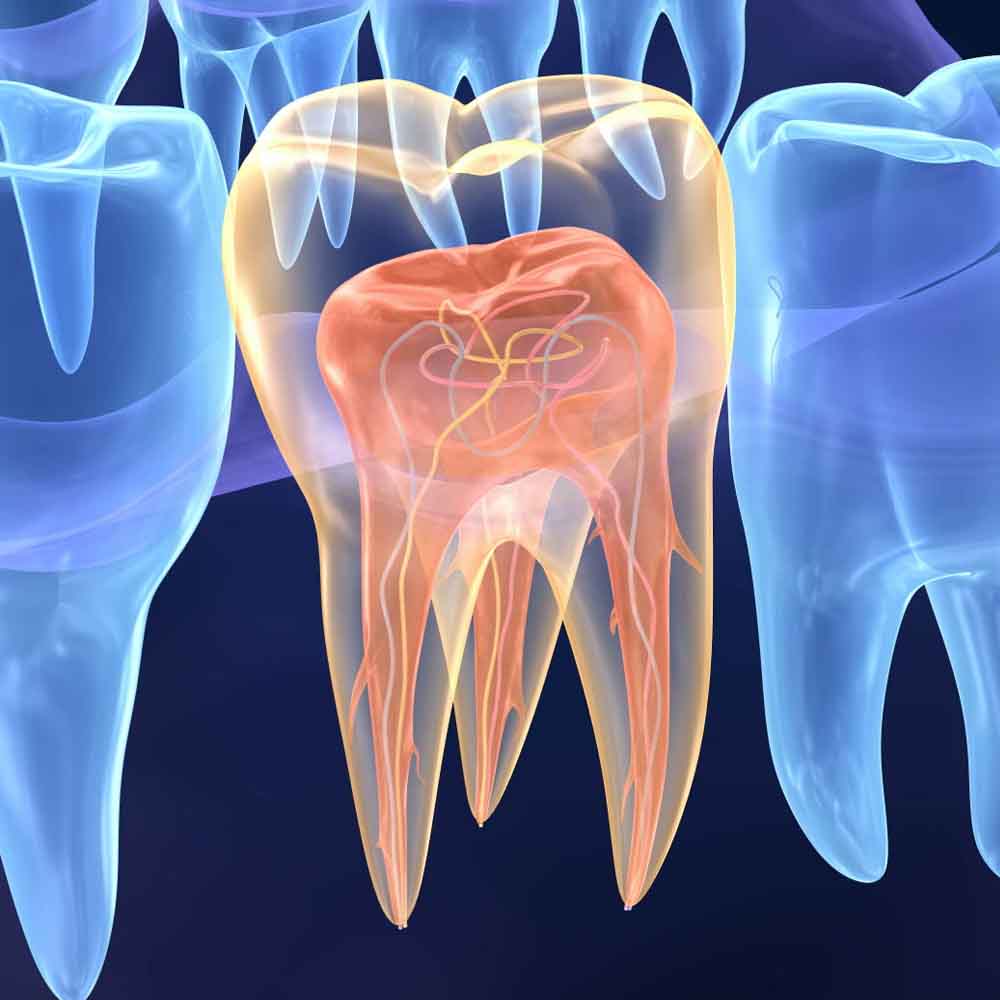 ENDODONTIA – Clínica Naturale